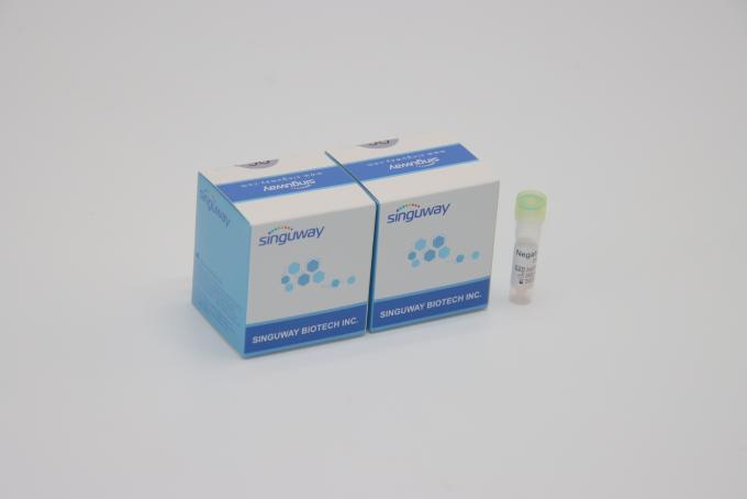 High Stability HCV Real Time PCR Kit HBV Hepatitis B Rapid Test Kit Lab ...